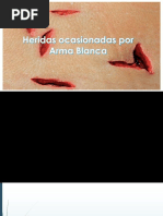 Anillos de Contusión y Enjugamiento | PDF | Mecanica clasica | Cambio