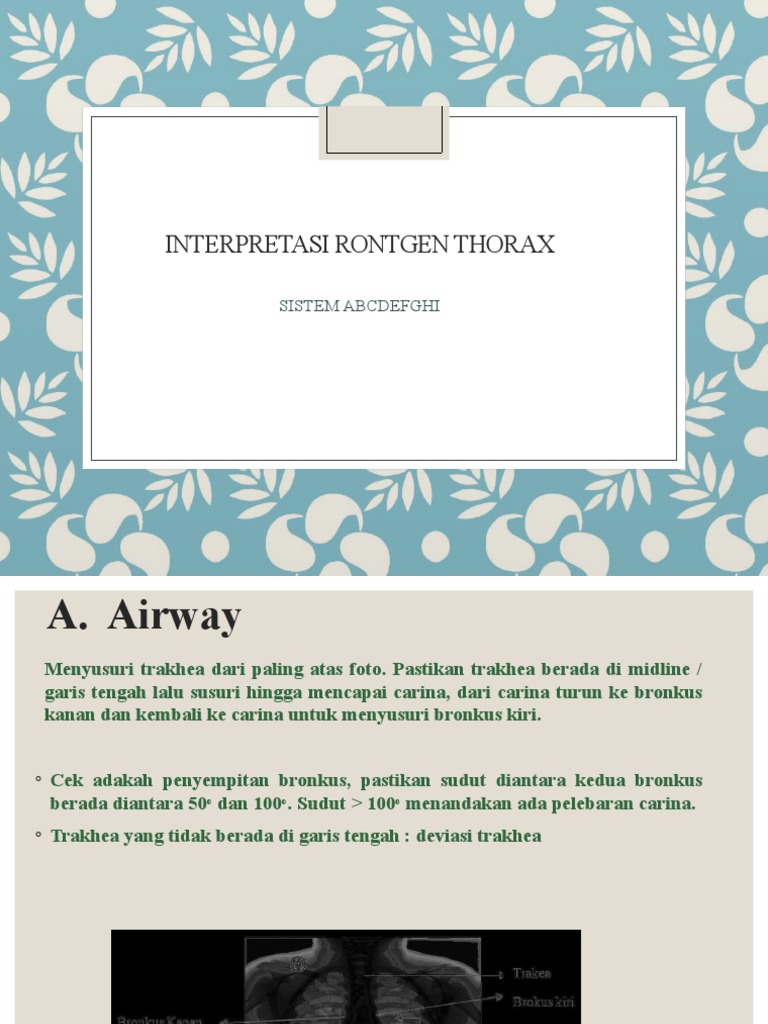 Interpretasi Rontgen Thorax Normal | PDF