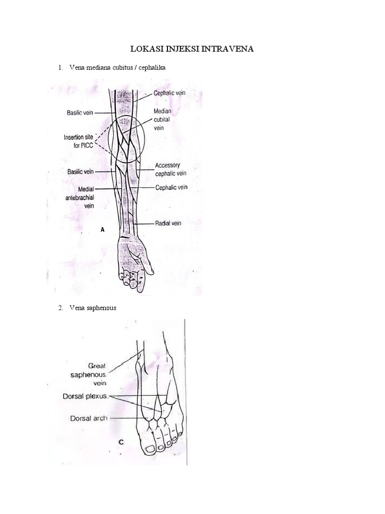 Lokasi Injeksi Intravena | PDF