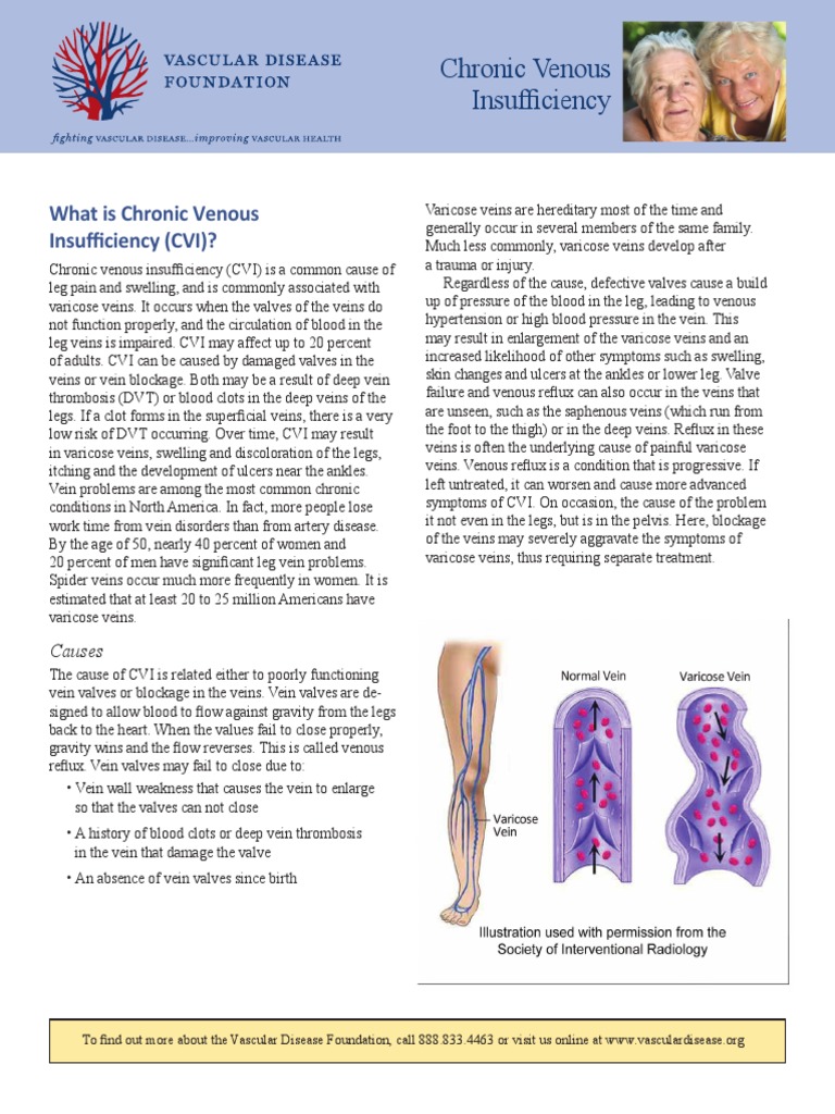 What Is Chronic Venous Insufficiency (CVI) ? | PDF | Varicose Veins | Vein