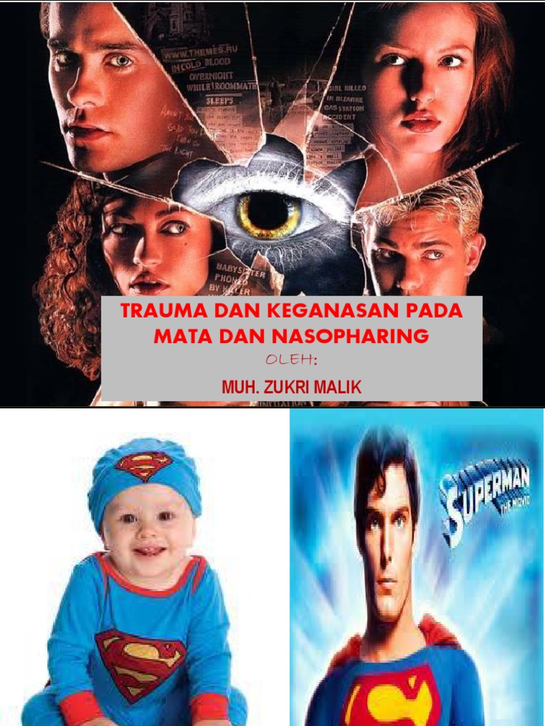 Trauma Orbital | PDF