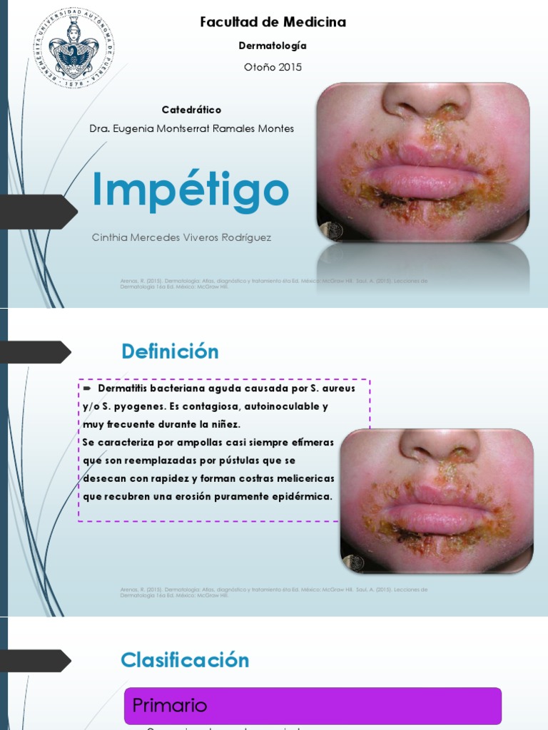 IMPETIGO | PDF | Staphylococcus Aureus | Microbiología