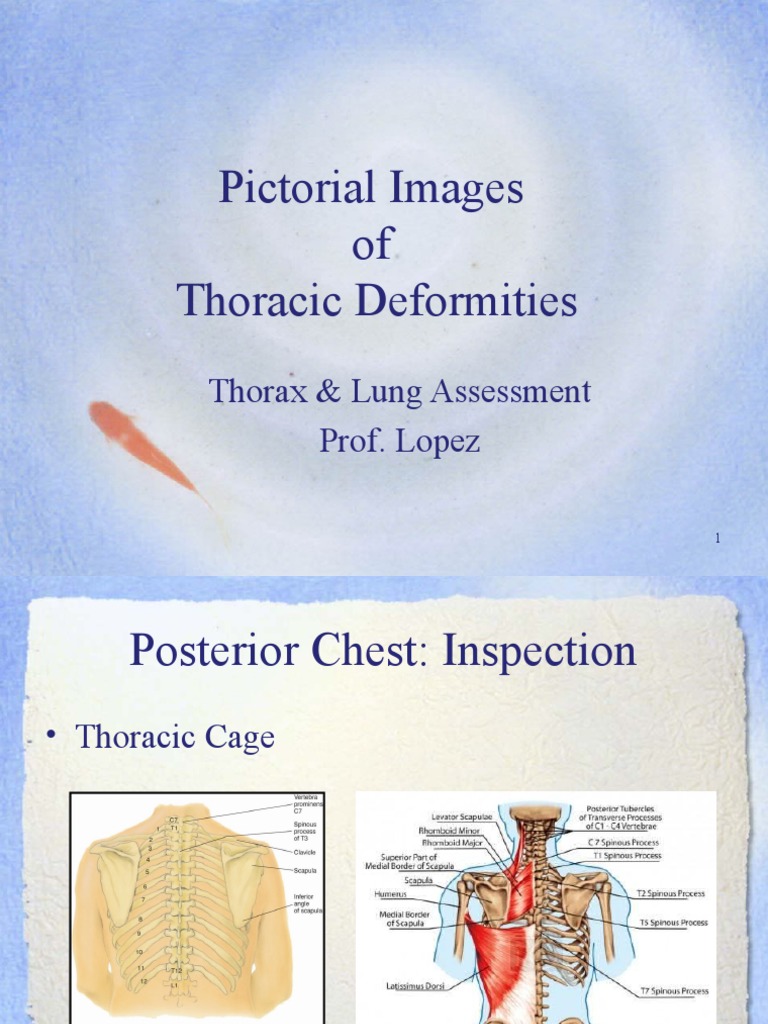 Thoracic Deformities Guide | PDF
