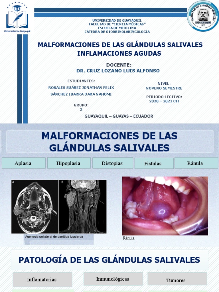 Sialoadenitis Aguda Bacteriana y Vírica | PDF | Medicina | Medicina CLINICA