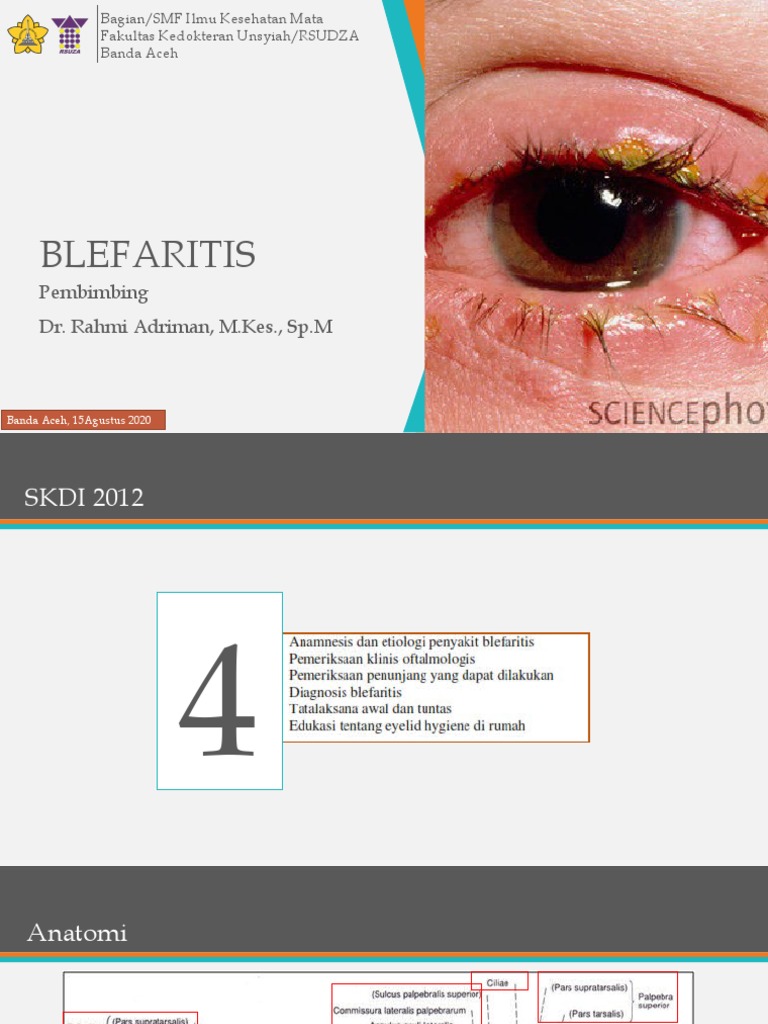 BLEFARITIS | PDF