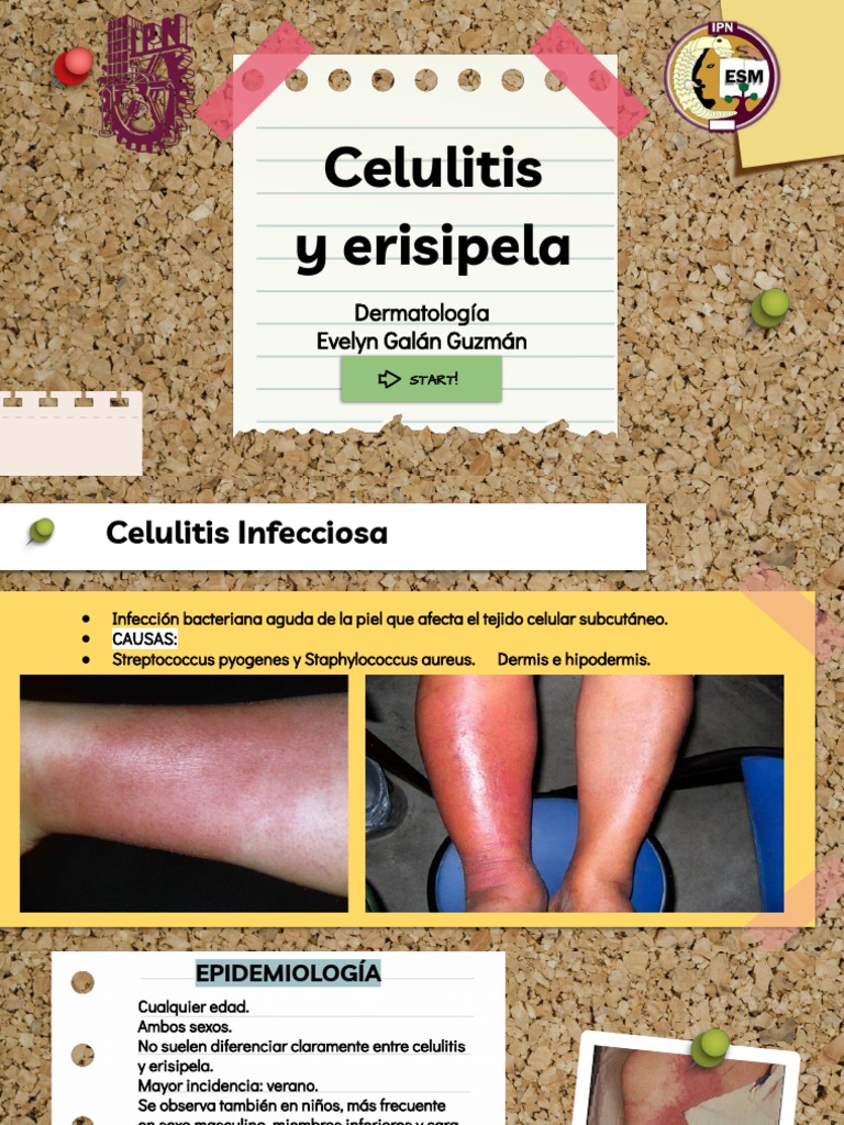 Celulitis y Erisipela | PDF | Rtt | Microbiología