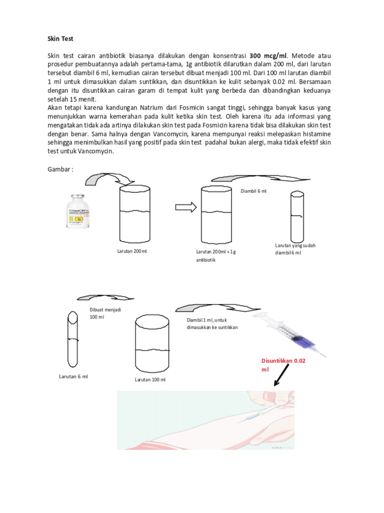 Cara Uji Skin Test Fosmicin PDF | PDF