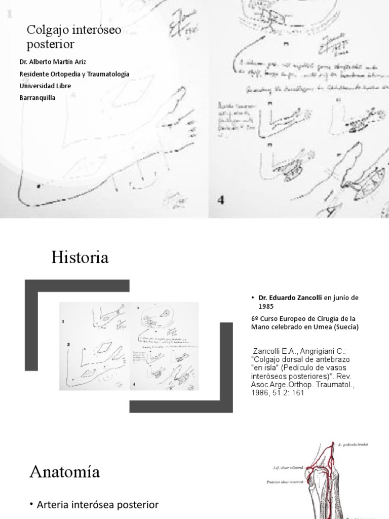 Colgajo Interoseo Posterior | PDF