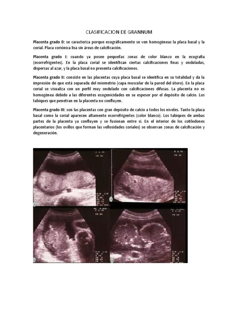 Clasificacion de Grannum | PDF | Placenta | Parto