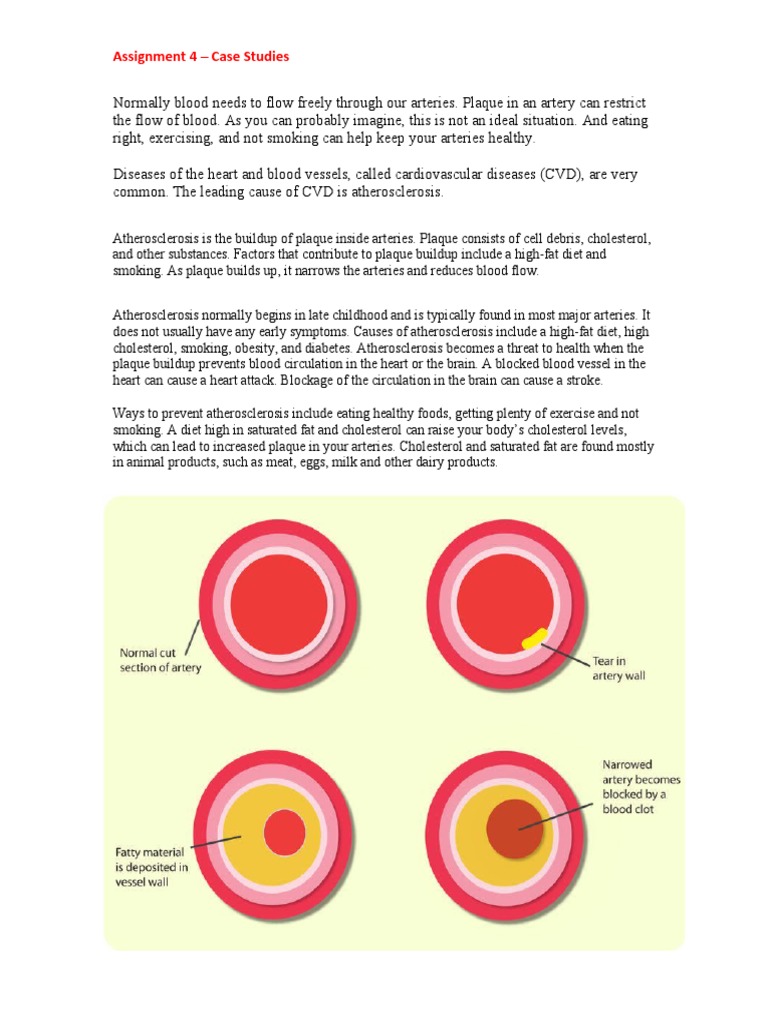 Assignment 4 - Cardiovascular Disease | PDF | Atherosclerosis | Atheroma
