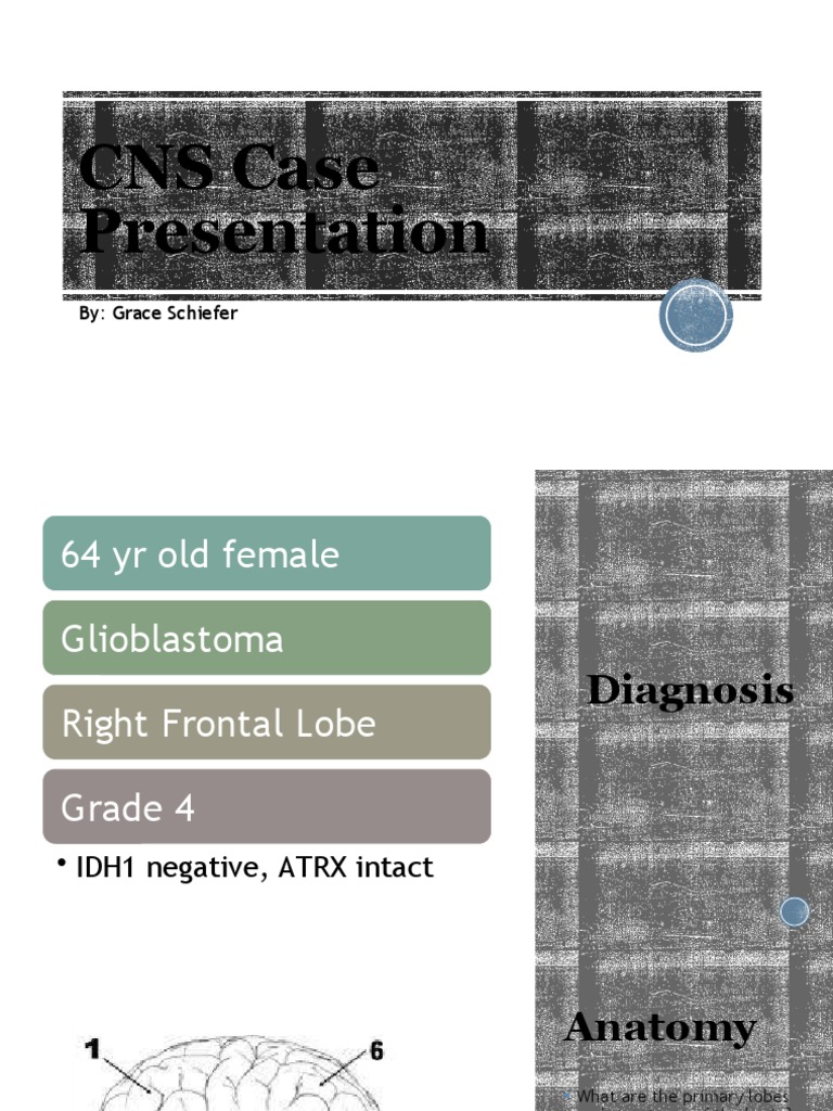 Cns Case Presentation | PDF | Brain Tumor | Glioma