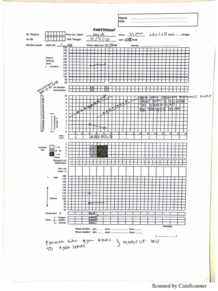 Contoh Pengisian Partograf | PDF