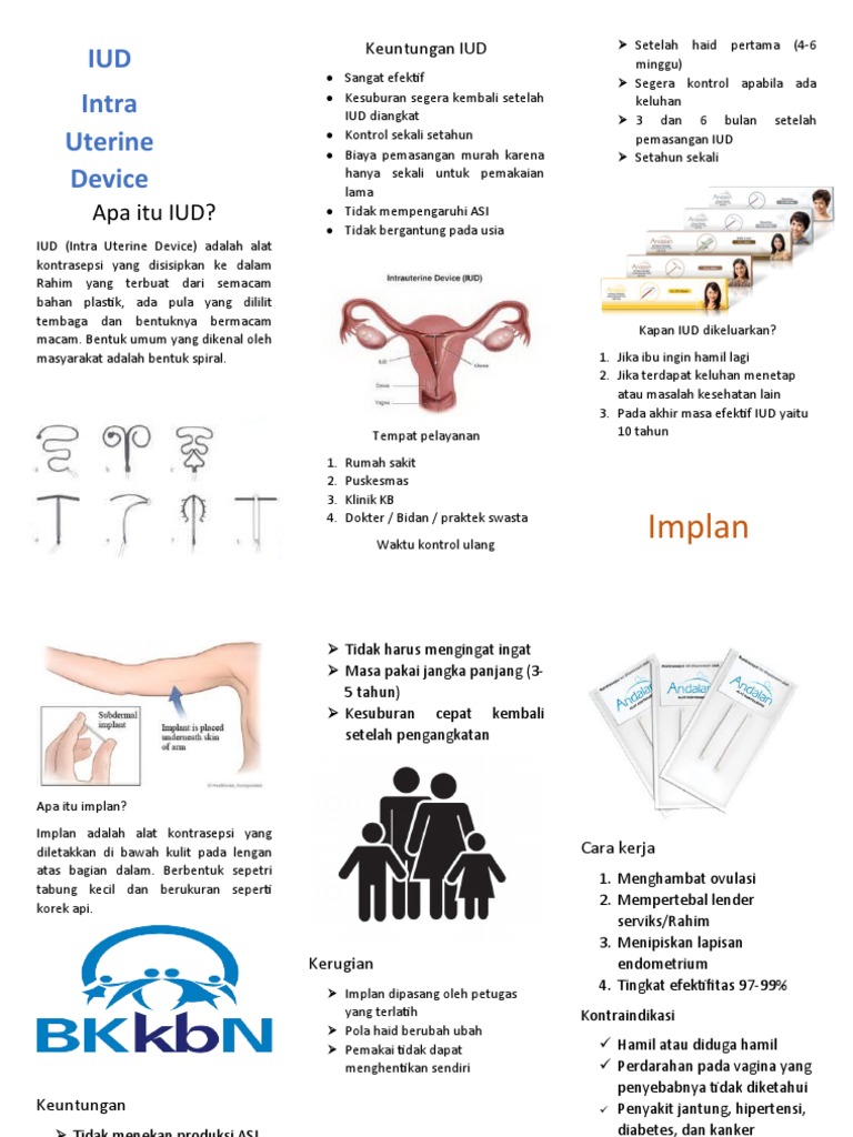 Leaflet Iud & Implant | PDF