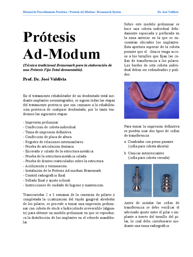Procedimiento de Prótesis Ad-Modum | PDF | Dentadura postiza | Tornillo