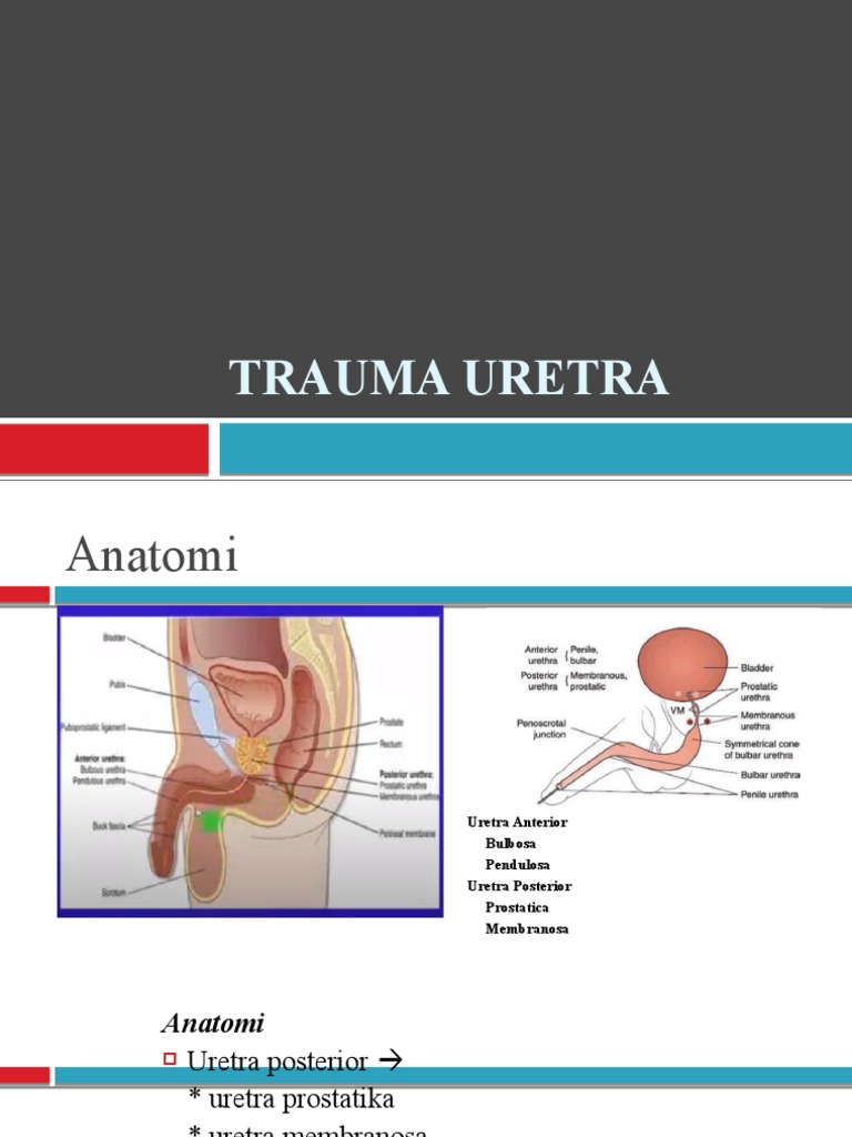 Trauma Uretra pada Pria | PDF