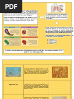 Fases de la Neumonía | PDF | Leucocito | Sangre