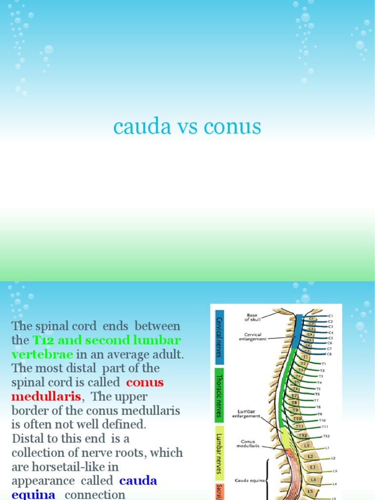 Cauda Equina Vs Conus Medullaris Syndrome