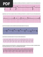 Evaluación Preguntas Del Examen Pre - Evaluacion de La AHA ACLS 2015 | PDF
