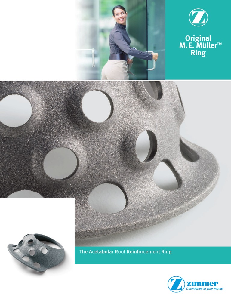 Original M.E. Müller Ring: The Acetabular Roof Reinforcement Ring | PDF ...