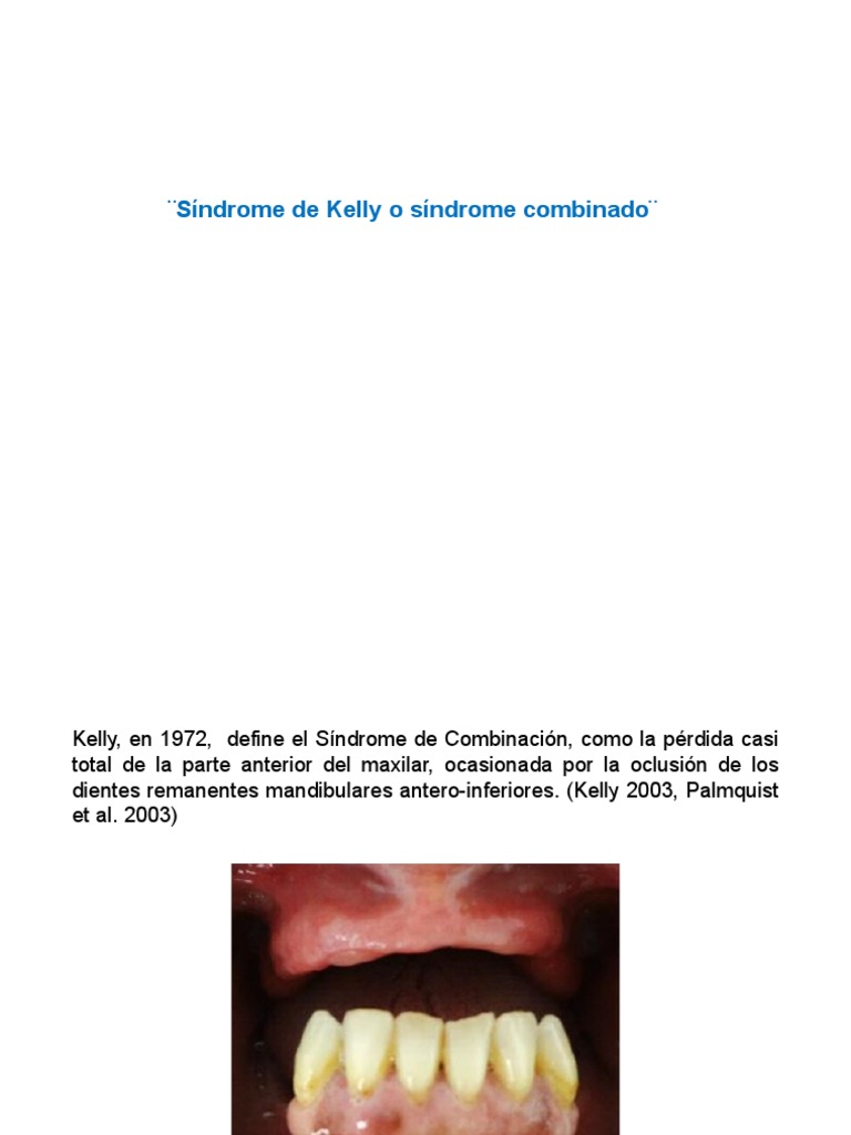 Síndrome de Kelly en Odontología | PDF | Ciencia y matemáticas
