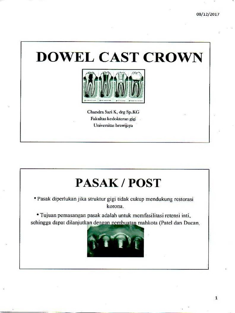Dowel Cast Crown | PDF