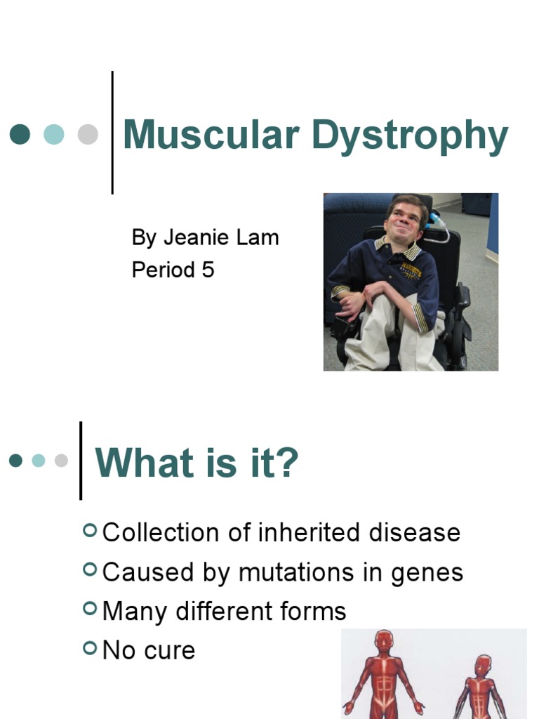 Overview of Muscular Dystrophy Types | PDF