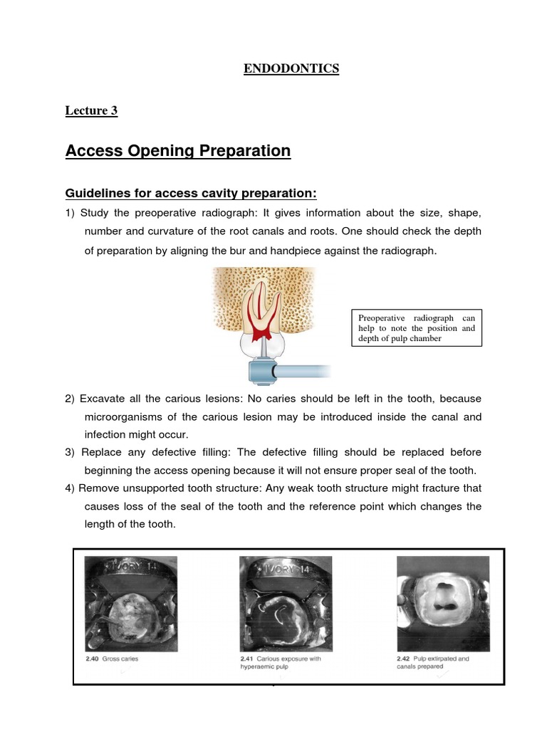Access Opening Preparation: Endodontics | PDF | Mouth | Dentistry