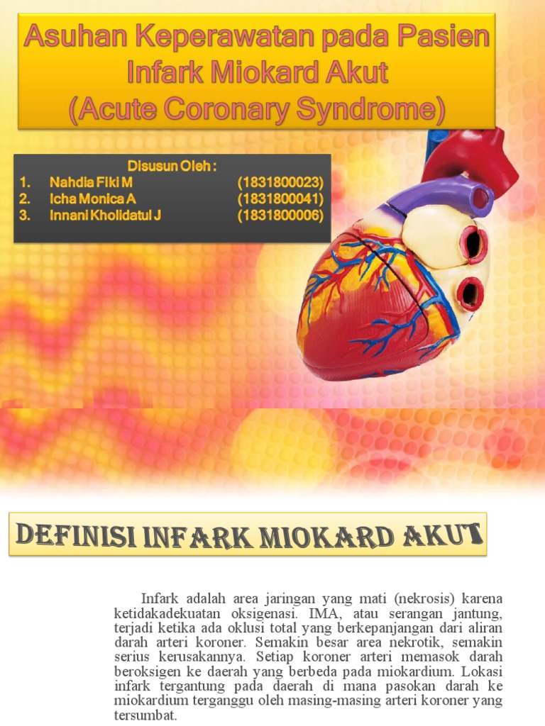 Infark Miokard | PDF