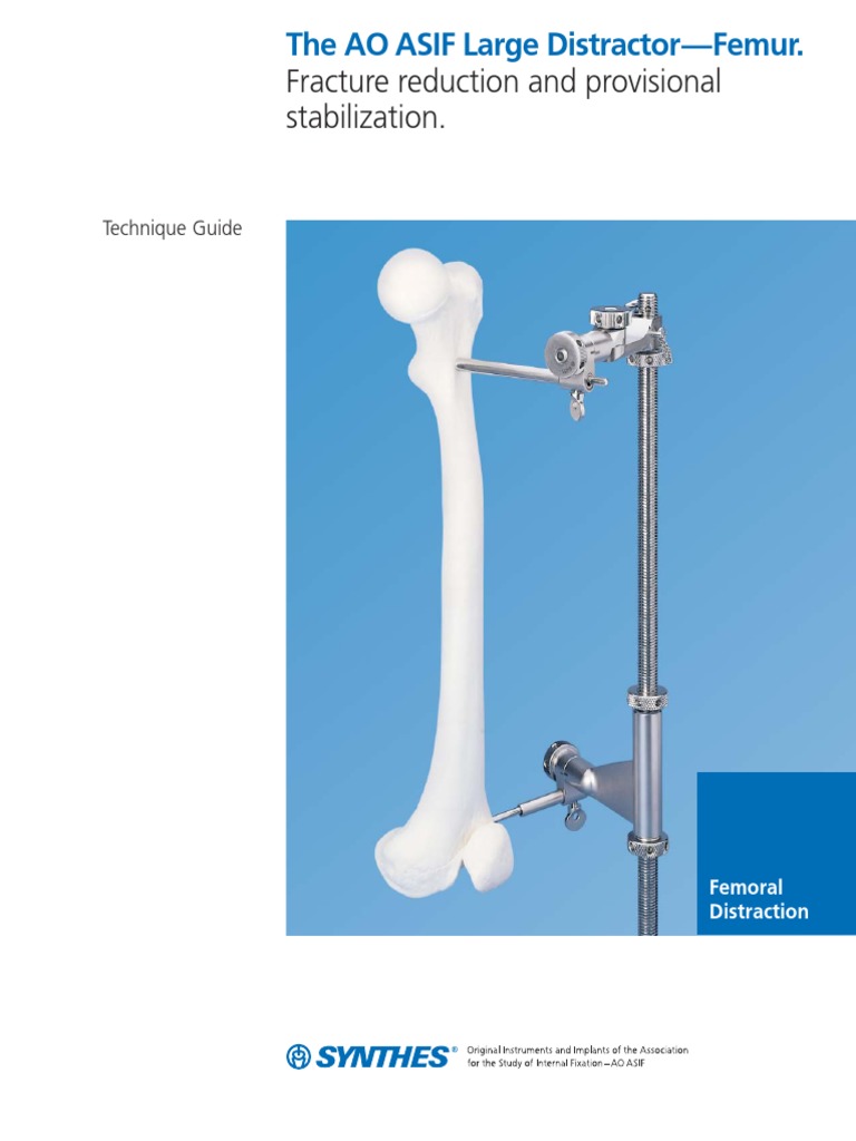 Large - Distractor - Femur Uputstvo | PDF | Nut (Hardware) | Screw