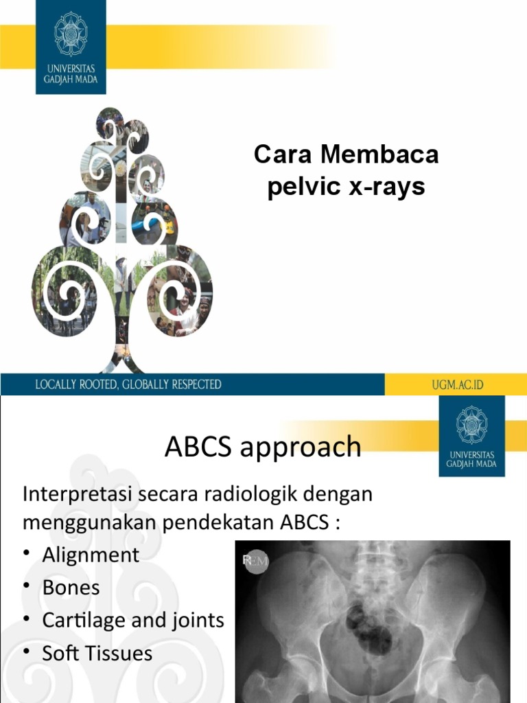 Membaca Rontgen Pelvis dengan ABCS | PDF
