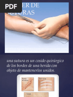 Guía de Sutura Colchonero Horizontal | PDF | Cirugía | Especialidades ...