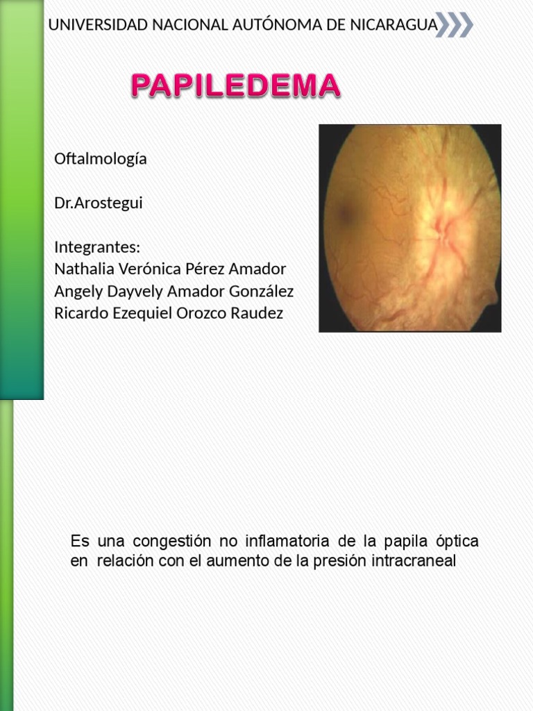 EDEMA DE PAPILA: CAUSAS, SIGNOS Y TRATAMIENTO | PDF | Angiología ...