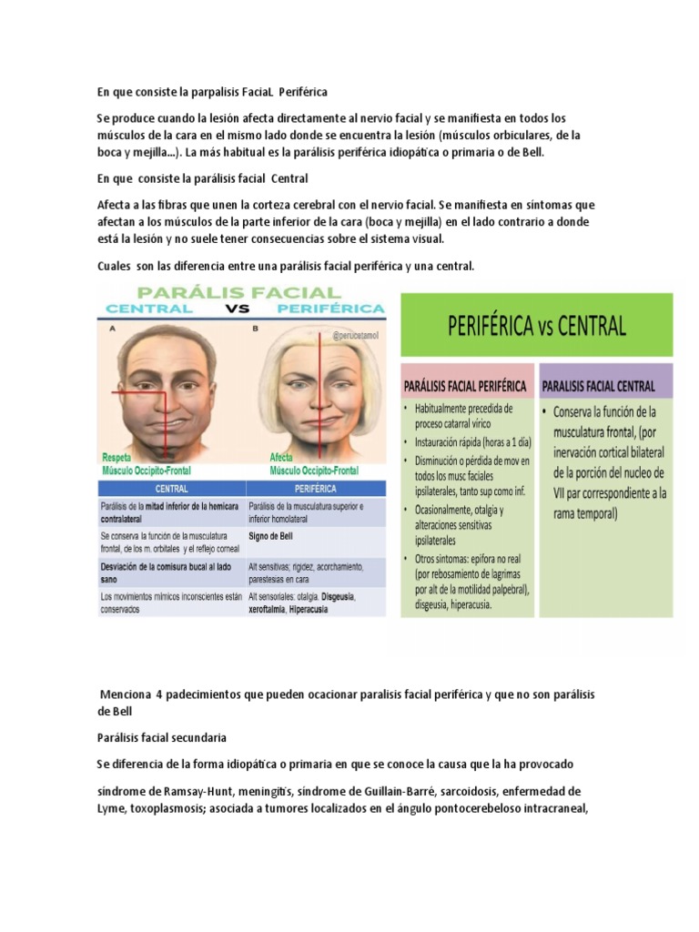 Comprendiendo las diferencias entre la parálisis facial periférica y ...