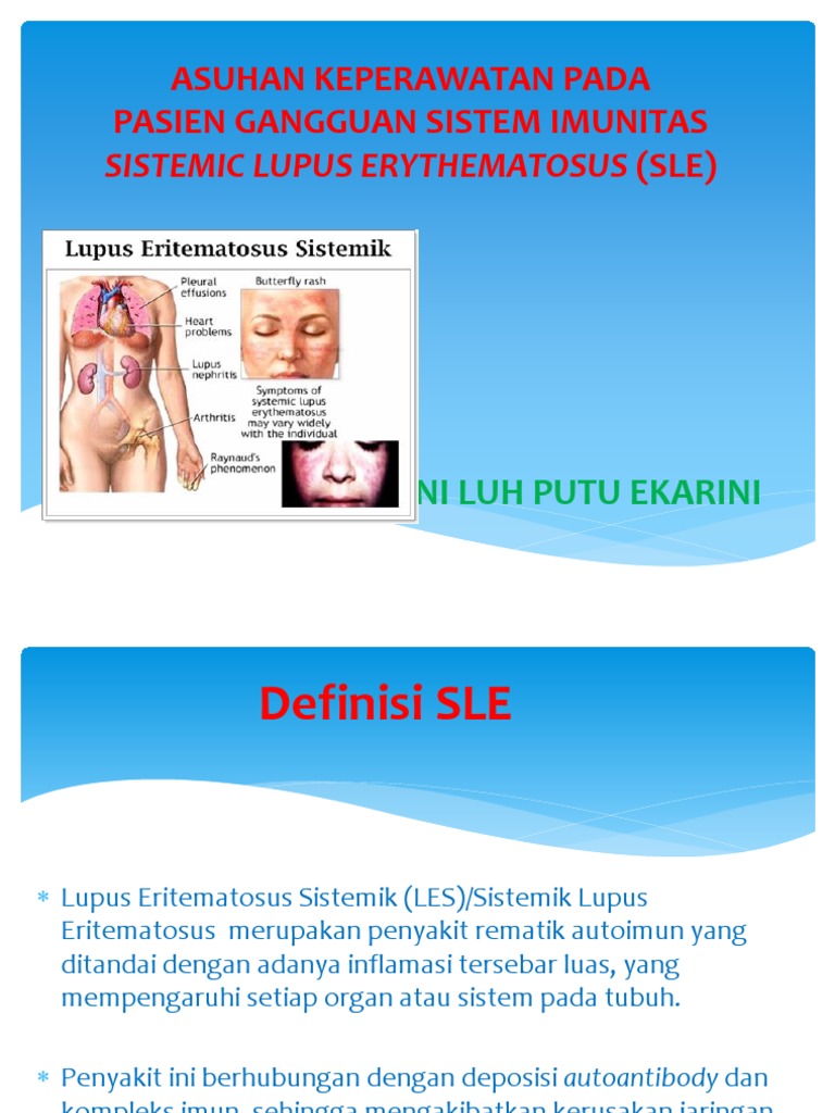 Askep Sle KMB2 - D3 - 2021 | PDF