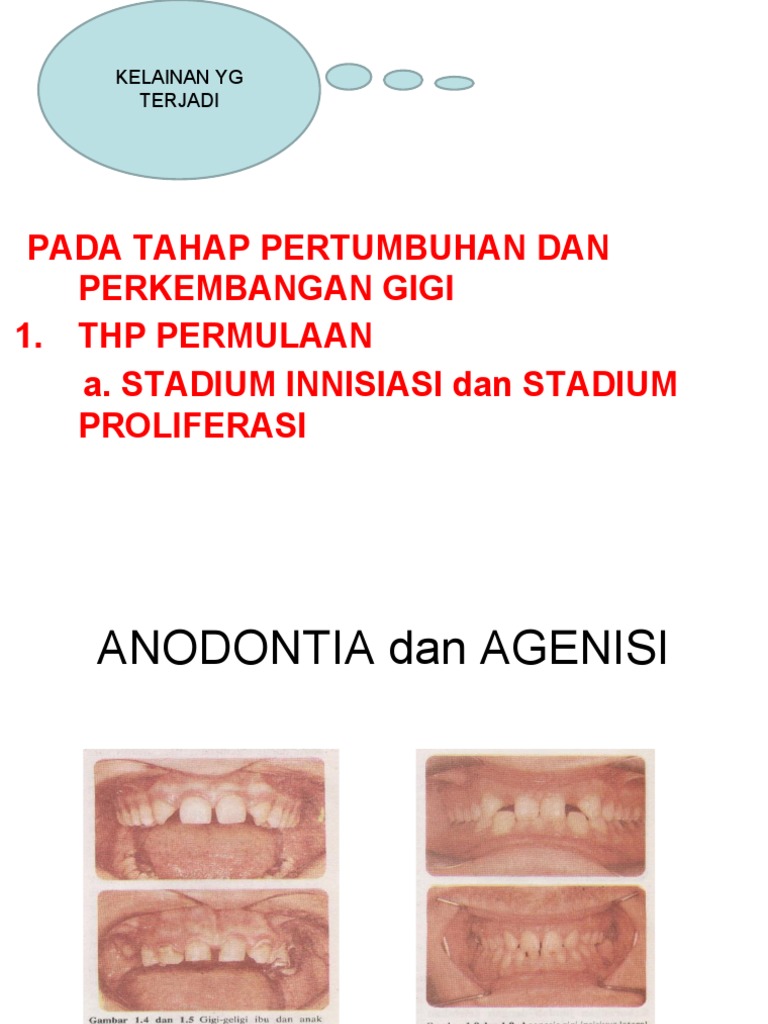 Kelainan Pertumbuhan Gigi | PDF