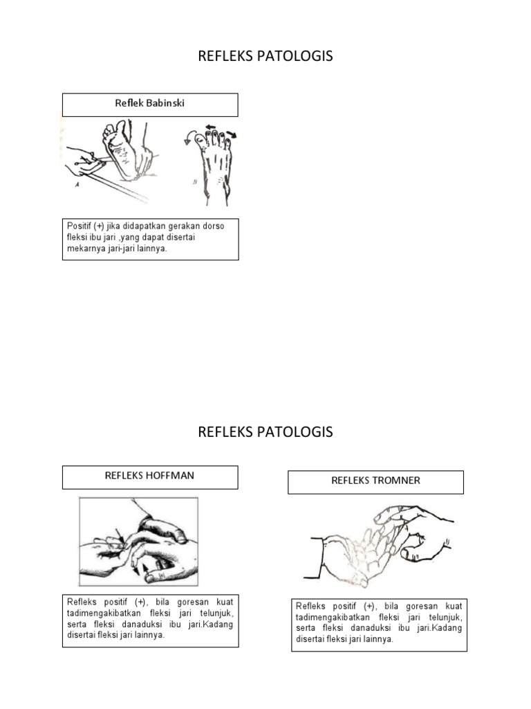 Refleks Patologis dan Pemeriksaannya | PDF