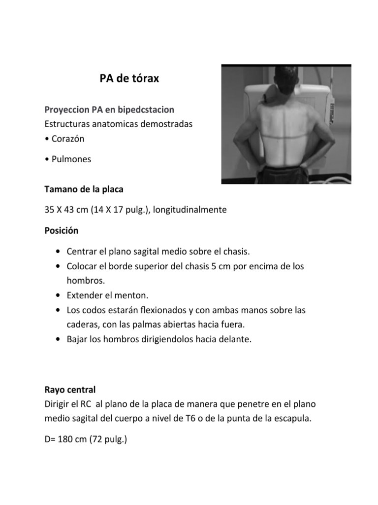 PA y AP de Tórax | PDF | Tórax | La columna vertebral