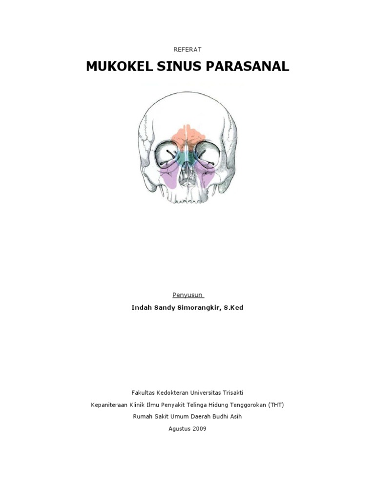 Mukokel Sinus Paranasal: Definisi dan Diagnosis | PDF
