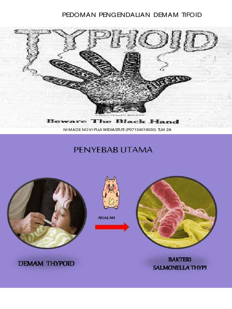 Pedoman Pengendalian Demam Tifoid | PDF