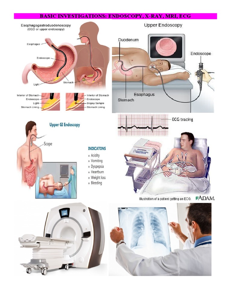 Basic Investigations: Endoscopy, X-Ray, Mri, Ecg | PDF | Endoscopy ...