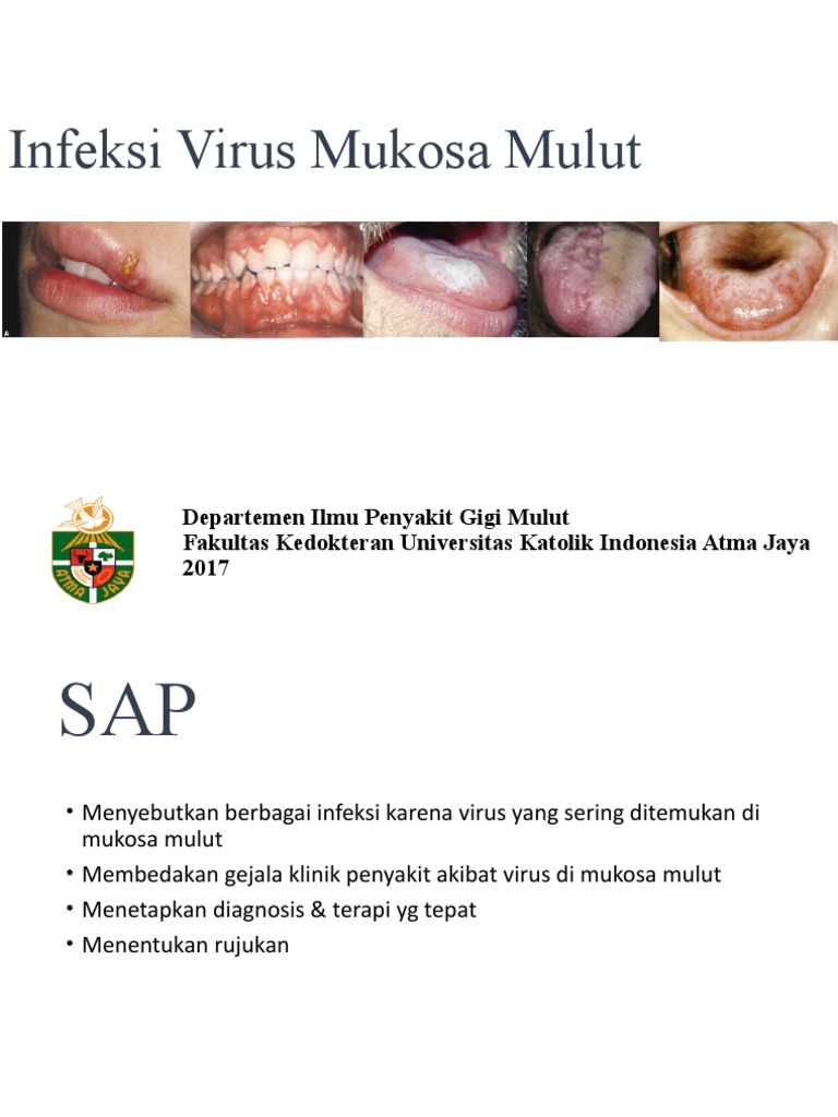 Infeksi Virus pada Mukosa Mulut: Gejala Klinis, Diagnosis dan Terapi | PDF