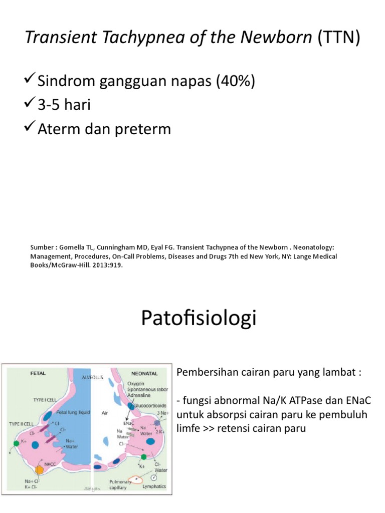 Transient Tachypnea of the Newborn (TTN): Causes, Symptoms, and ...
