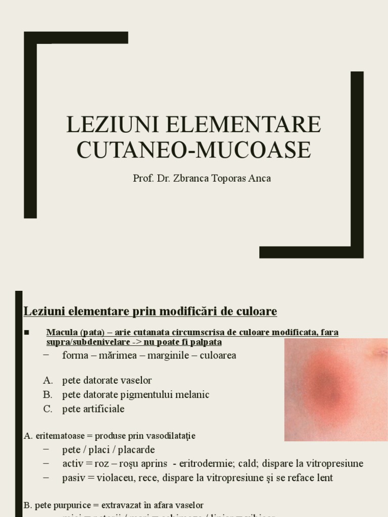 Leziuni Elementare Cutaneo-Mucoase | PDF