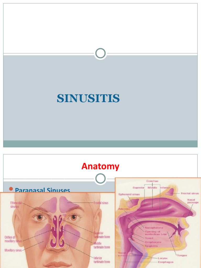 Sinusitis | PDF | Human Nose | Respiratory System