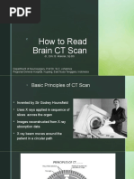 Ficat and Arlet Staging of Avascular Necrosis of Femoral Head | PDF ...