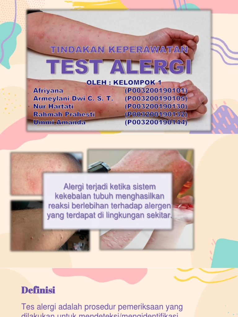 Test Alergi-Klpk 1 | PDF