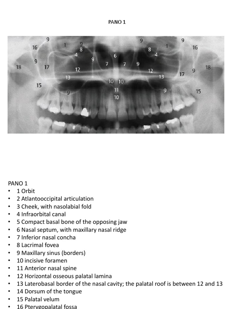 An Anatomical Guide to Structures Visible on Panoramic Radiographs of ...