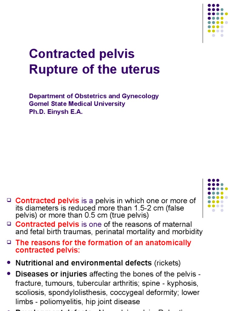 Contracted Pelvis: Rupture of The Uterus | PDF | Pelvis | Childbirth