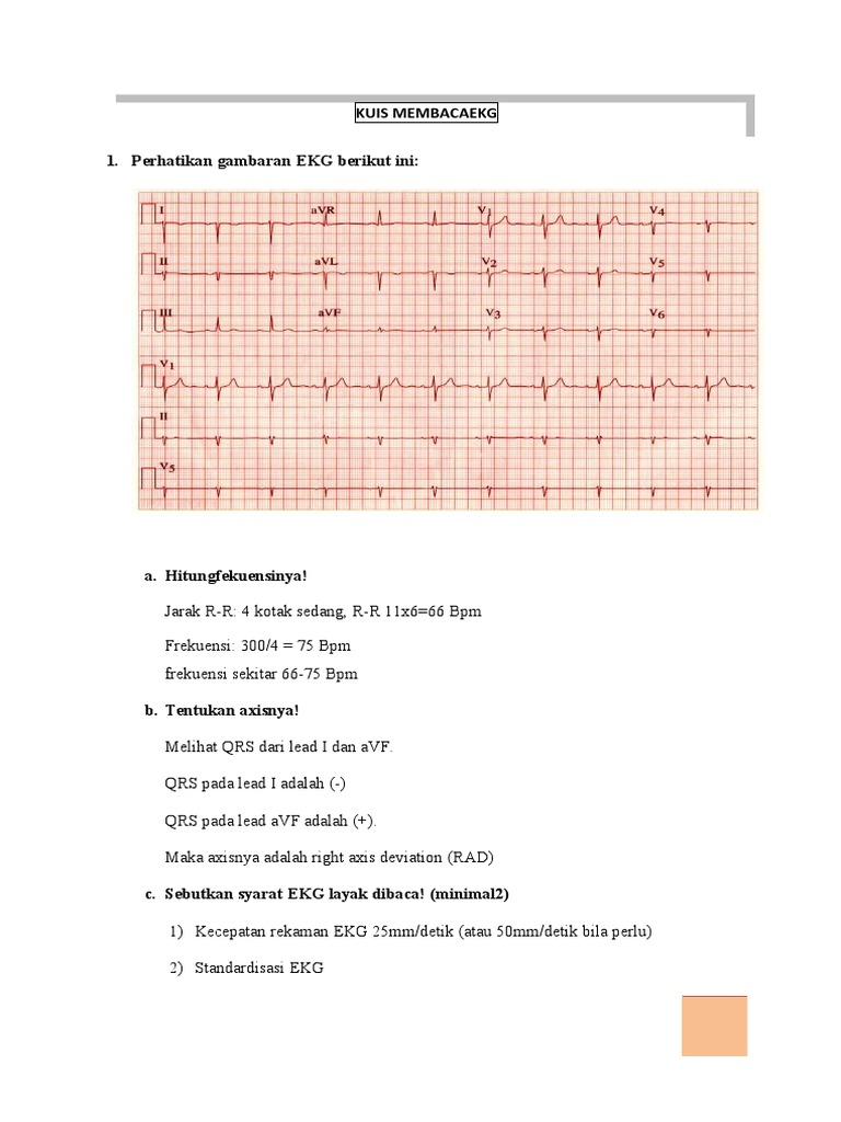G1A119053 Willy Tugas Ekg 4.1 | PDF | Sains & Matematika
