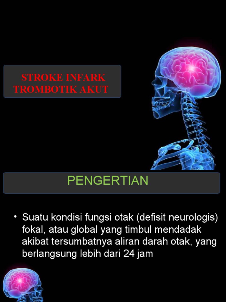 Stroke Infark Trombotik Akut | PDF